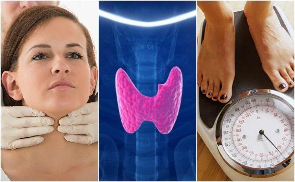 10 symptomen van mogelijke hypothyreoïdie - Gezonder Leven